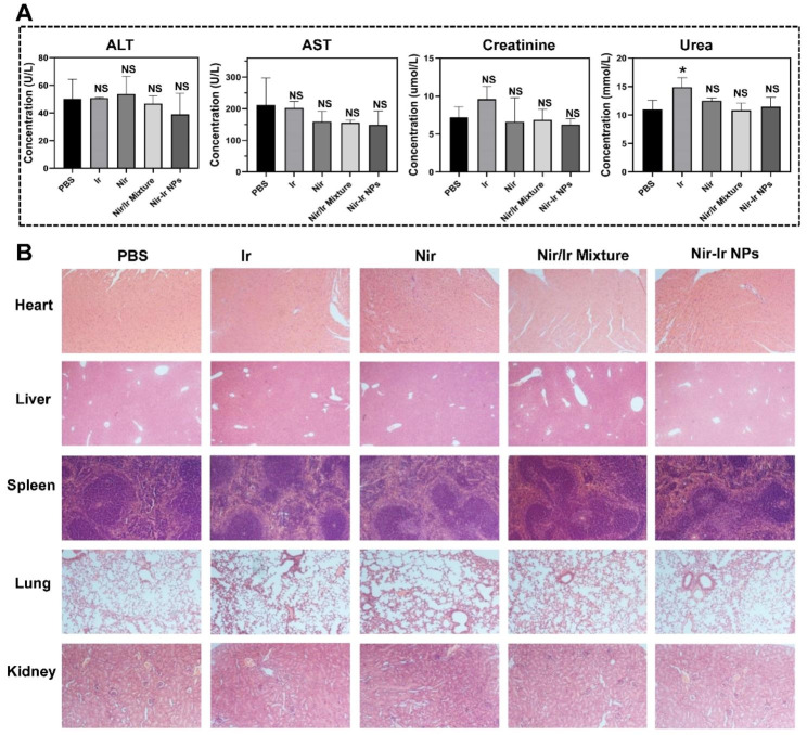 A carrier-free supramolecular nano-twin-drug for overcoming irinotecan-resistance and enhancing ...