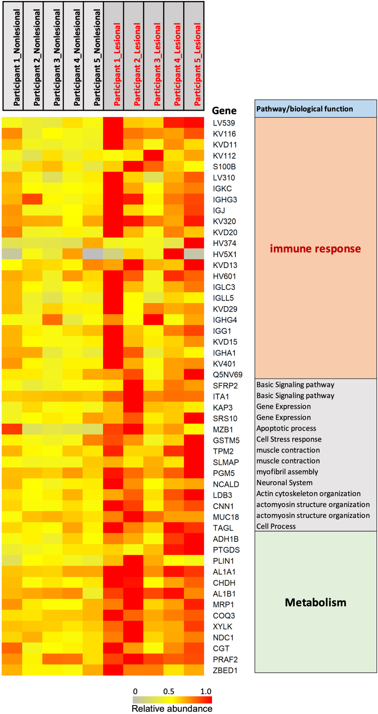 Proteomic Profiling of Central Centrifugal Cicatricial Alopecia Reveals Role of Humoral Immune ...
