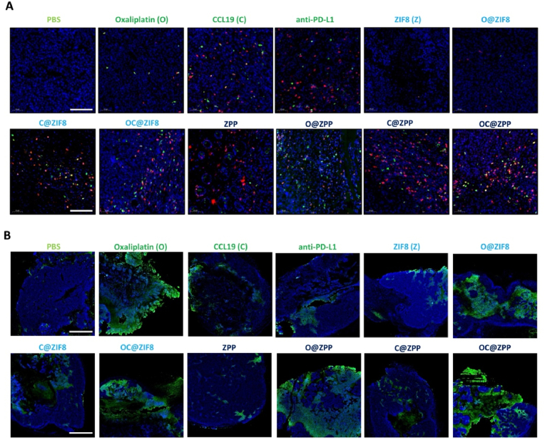 Reshaping tumor immune microenvironment and modulating T cell function based on hierarchical ...
