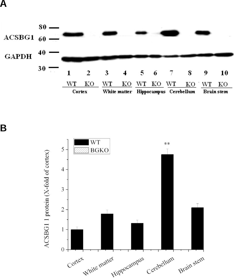 Role of ACSBG1 in brain lipid metabolism and X-linked ... Role of ACSBG1 in brain lipid metabolism and X-linked ...