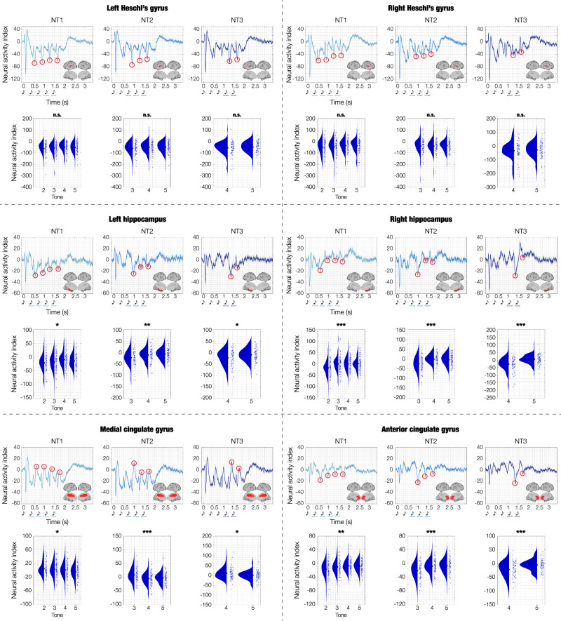 Spatiotemporal brain hierarchies of auditory memory recognition and predictive coding - PMC
