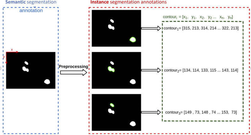 Deep learning model applied to real-time delineation of colorectal polyps - PMC