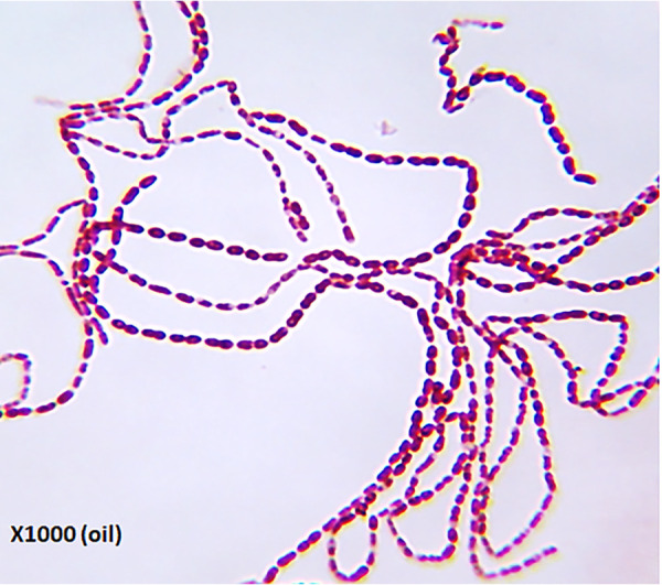 Complete Genome Sequence of Moraxella osloensis Strain YV1, Isolated from an Australian ...