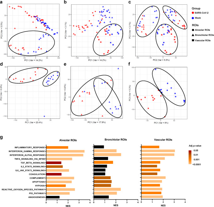 Spatial transcriptome atlas reveals pulmonary microstructure-specific ...