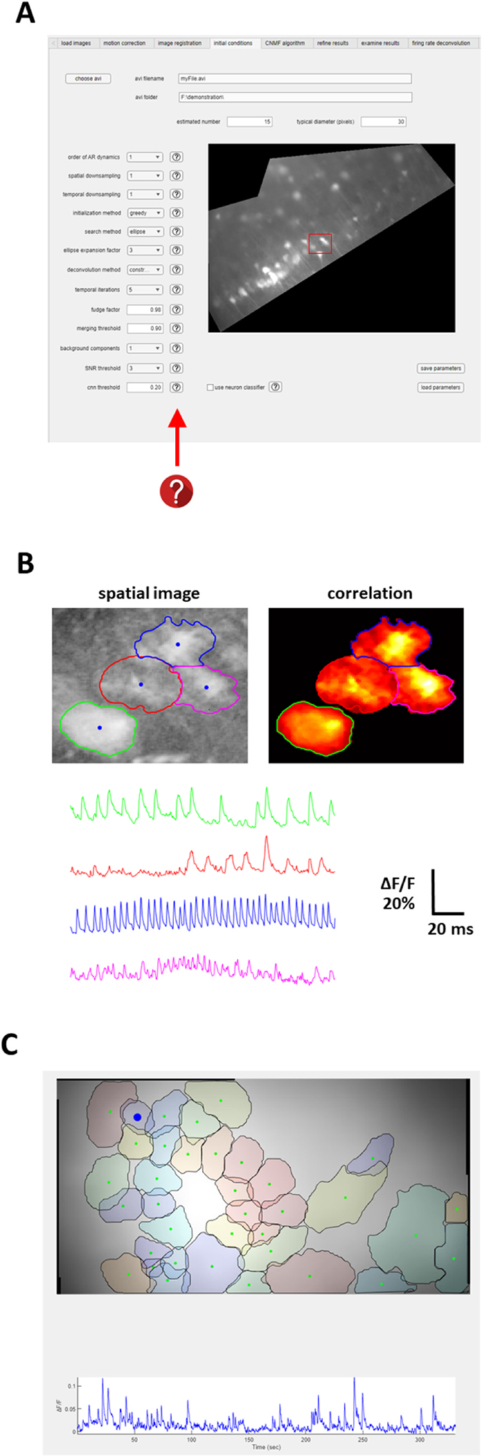 A simple MATLAB toolbox for analyzing calcium imaging data in vitro and in vivo - PMC
