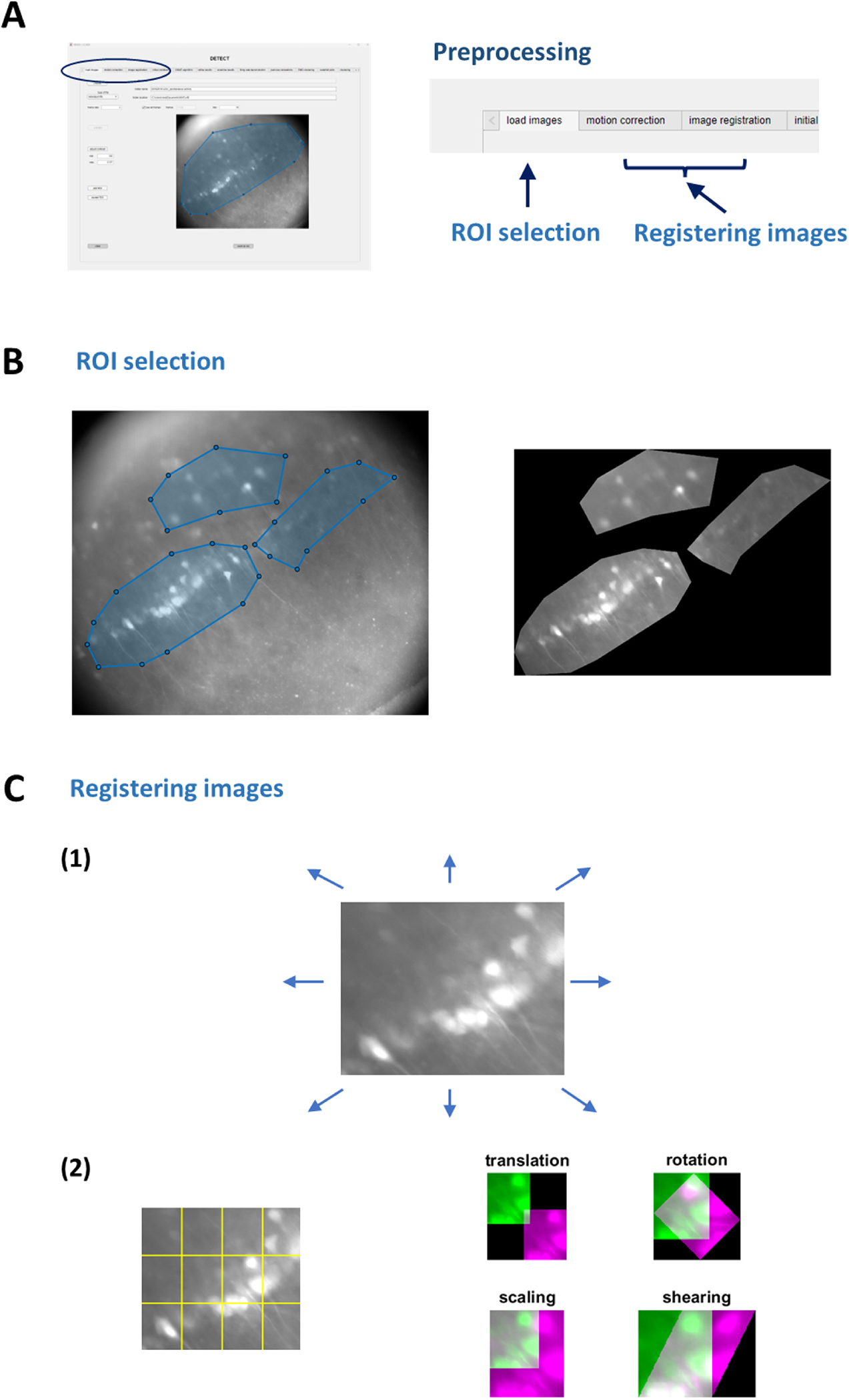 A simple MATLAB toolbox for analyzing calcium imaging data in vitro and in vivo - PMC