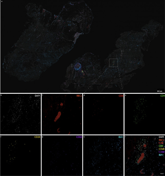 Optimizing Colocalized Cell Counting Using Automated and Semiautomated Methods - PMC