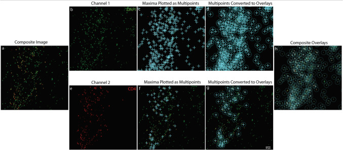 Optimizing Colocalized Cell Counting Using Automated and Semiautomated Methods - PMC