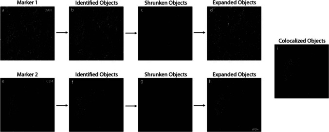 Optimizing Colocalized Cell Counting Using Automated and Semiautomated Methods - PMC