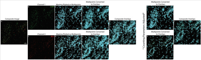 Optimizing Colocalized Cell Counting Using Automated and Semiautomated Methods - PMC