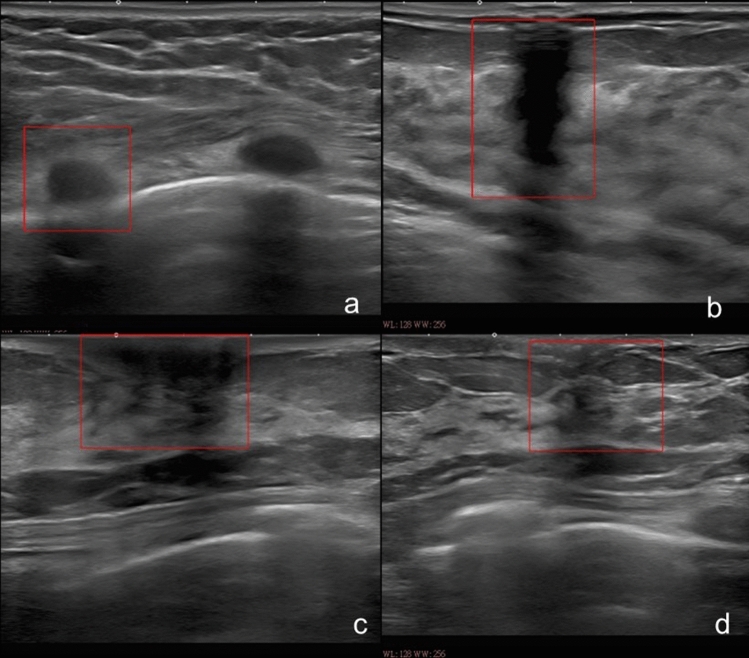 Examining the effectiveness of a deep learning-based computer-aided breast cancer detection ...
