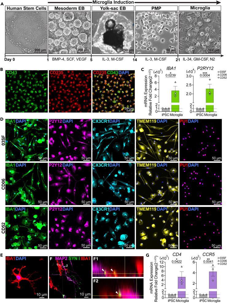 Sustained Type I Interferon Signaling After Human Immunodeficiency