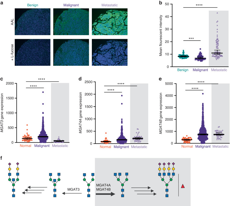 Diagnosing and staging epithelial ovarian cancer by serum glycoproteomic profiling - PMC