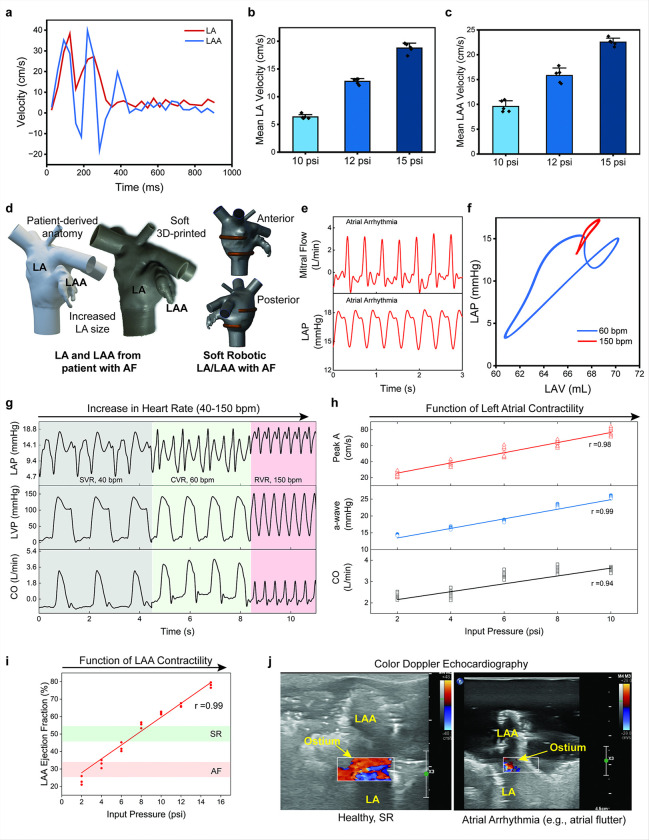 Integrating soft robotics and computational models to study left atrial hemodynamics and device ...