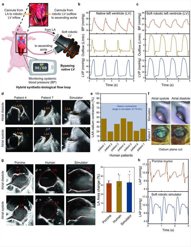 Integrating soft robotics and computational models to study left atrial hemodynamics and device ...