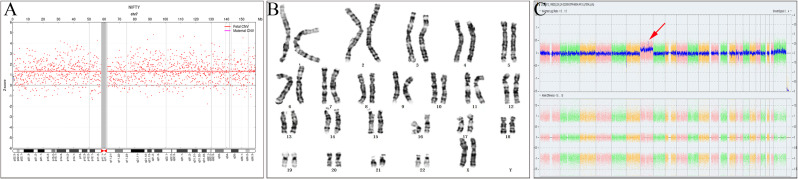 Prenatal diagnosis of a trisomy 7 mosaic case: CMA, CNV-seq, karyotyping, interphase FISH, and ...