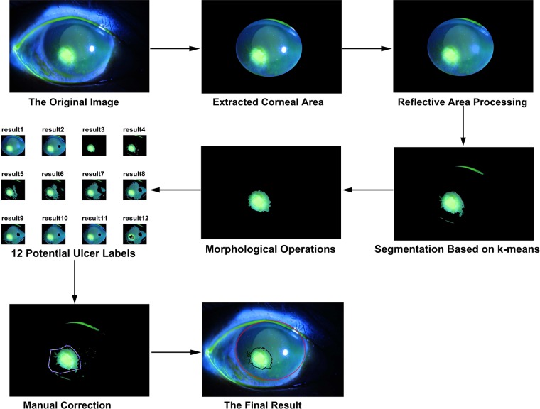 The SUSTech-SYSU dataset for automatically segmenting and classifying corneal ulcers - PMC
