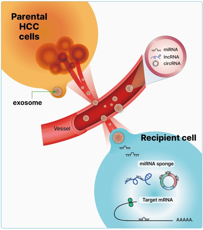 Clinical Significance Of Exosomal Noncoding Rnas In Hepatocellular