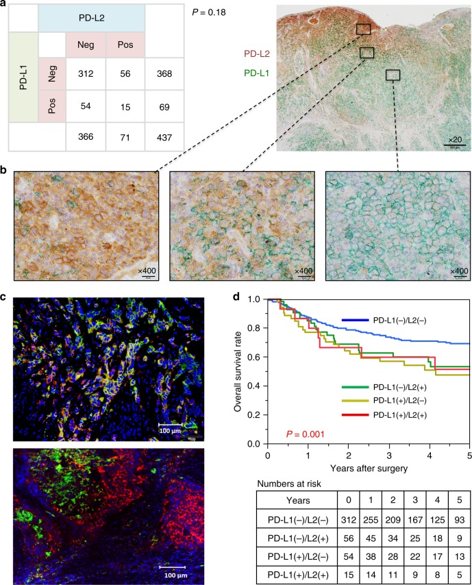 Prognostic and clinical impact of PD-L2 and PD-L1 expression in a cohort of 437 oesophageal ...