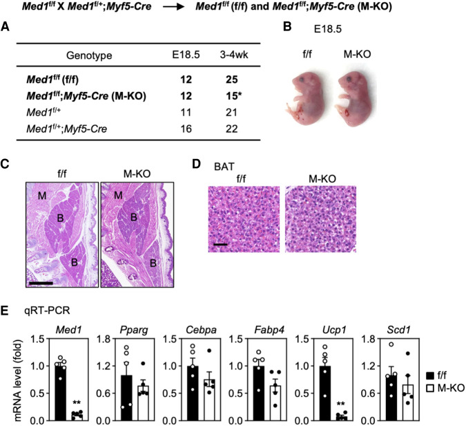 MED1 is a lipogenesis coactivator required for postnatal adipose expansion - PMC