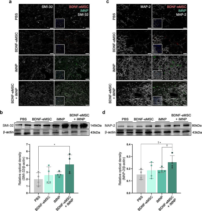 Combination of induced pluripotent stem cell-derived motor neuron progenitor cells with ...