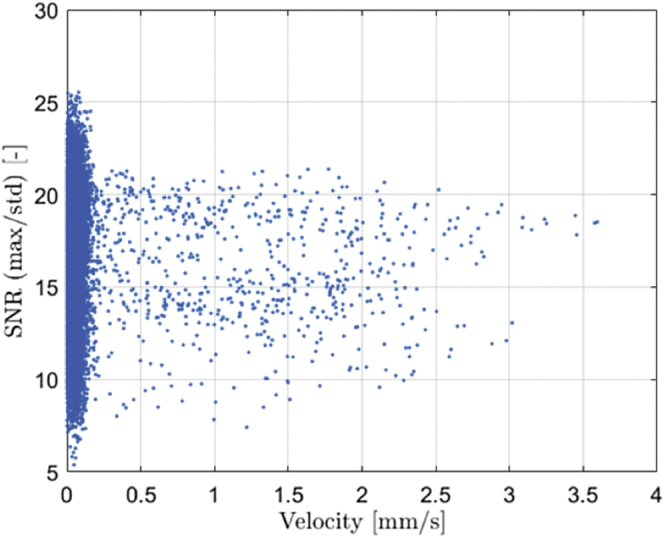 Clinical Evaluation of an Instrument-Integrated OCT-Based Distance Sensor for Robotic ...