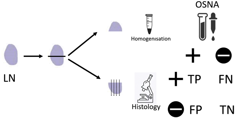 Evaluation of accuracy of one-step nucleic acid amplification (OSNA) in diagnosis of lymph node ...
