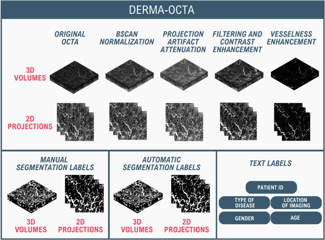 DERMA-OCTA: A Comprehensive Dataset and Preprocessing Pipeline for Dermatological OCTA Vessel ...
