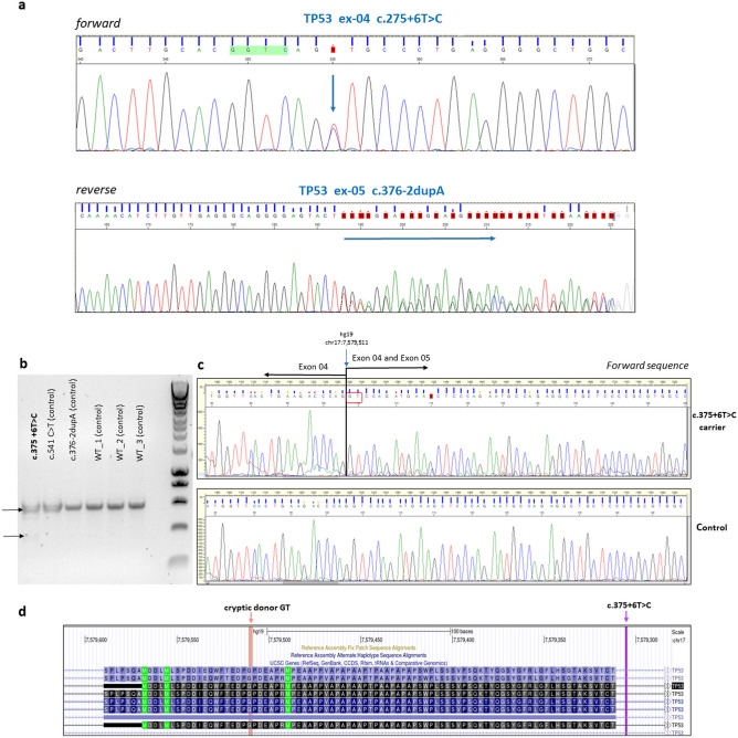 Challenging interpretation of germline TP53 variants based on the experience of a national ...