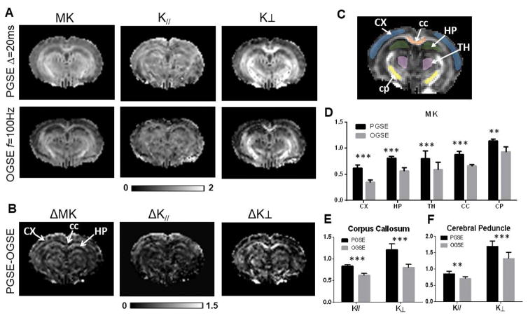 Oscillating Gradient Diffusion Kurtosis Imaging of Normal and Injured Mouse Brains - PMC