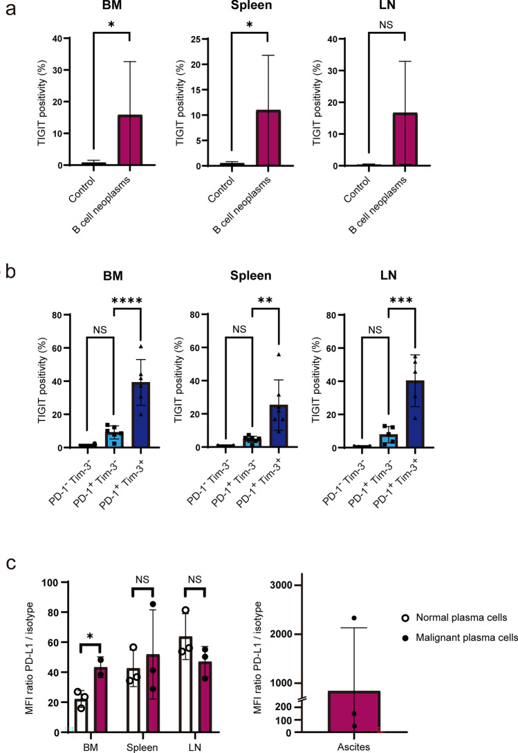 The pathogenetic significance of exhausted T cells in a mouse model of mature B cell neoplasms - PMC