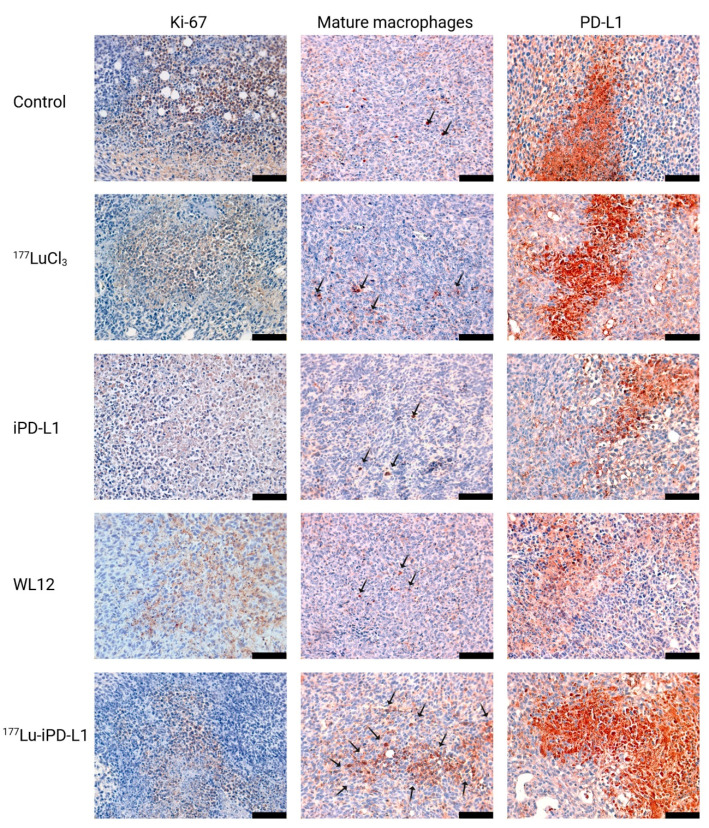 Lutetium-177 labeled iPD-L1 as a novel immunomodulator for cancer-targeted radiotherapy - PMC