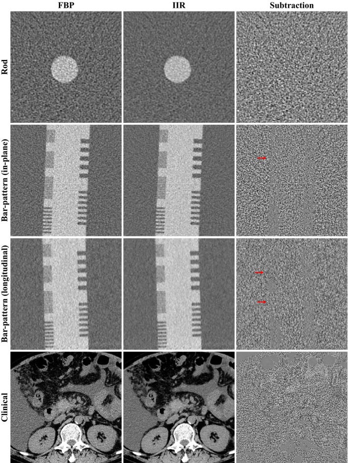 Quality evaluation of image‐based iterative reconstruction for CT ...