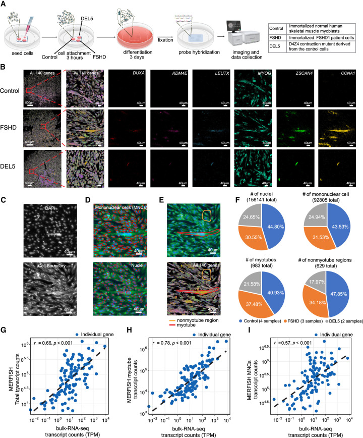 Single-cell spatial transcriptomics reveals a dystrophic trajectory ...