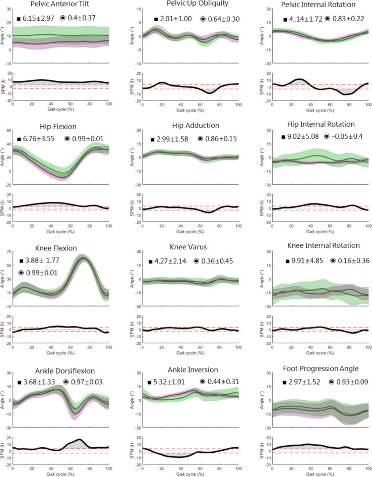 A comparison of lower body gait kinematics and kinetics between Theia3D markerless and marker ...