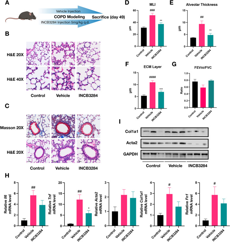 Targeting Ccl2 Ccr2 Signaling Pathway Alleviates Macrophage Dysfunction