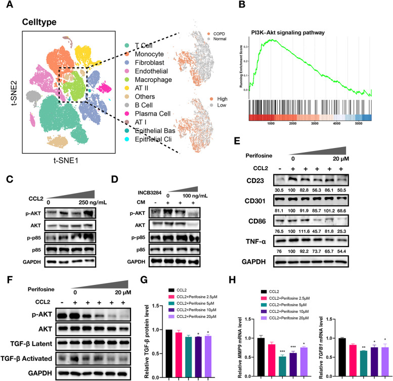 Targeting Ccl2 Ccr2 Signaling Pathway Alleviates Macrophage Dysfunction