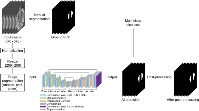 Deep learning-based fully automatic segmentation of the maxillary sinus on cone-beam computed ...