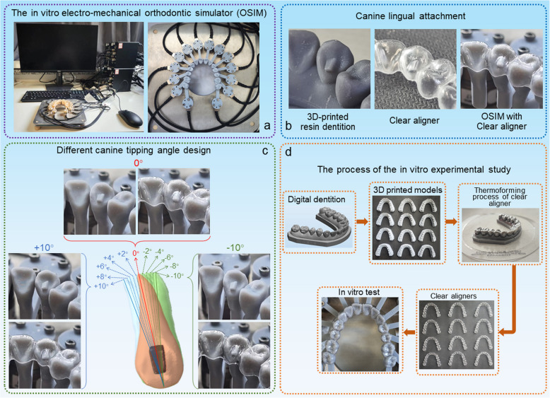 The effect of canine lingual attachments during maxillary arch distalization with clear aligner ...