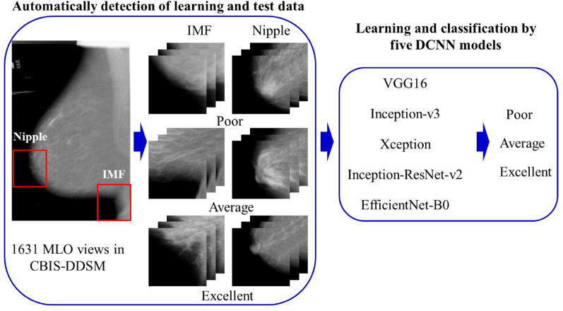 Quality control system for mammographic breast positioning using deep learning - PMC