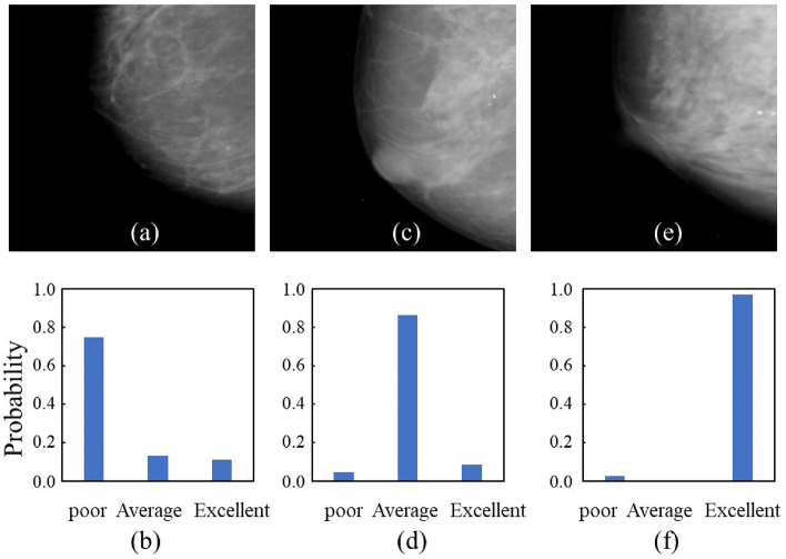 Quality control system for mammographic breast positioning using deep learning - PMC