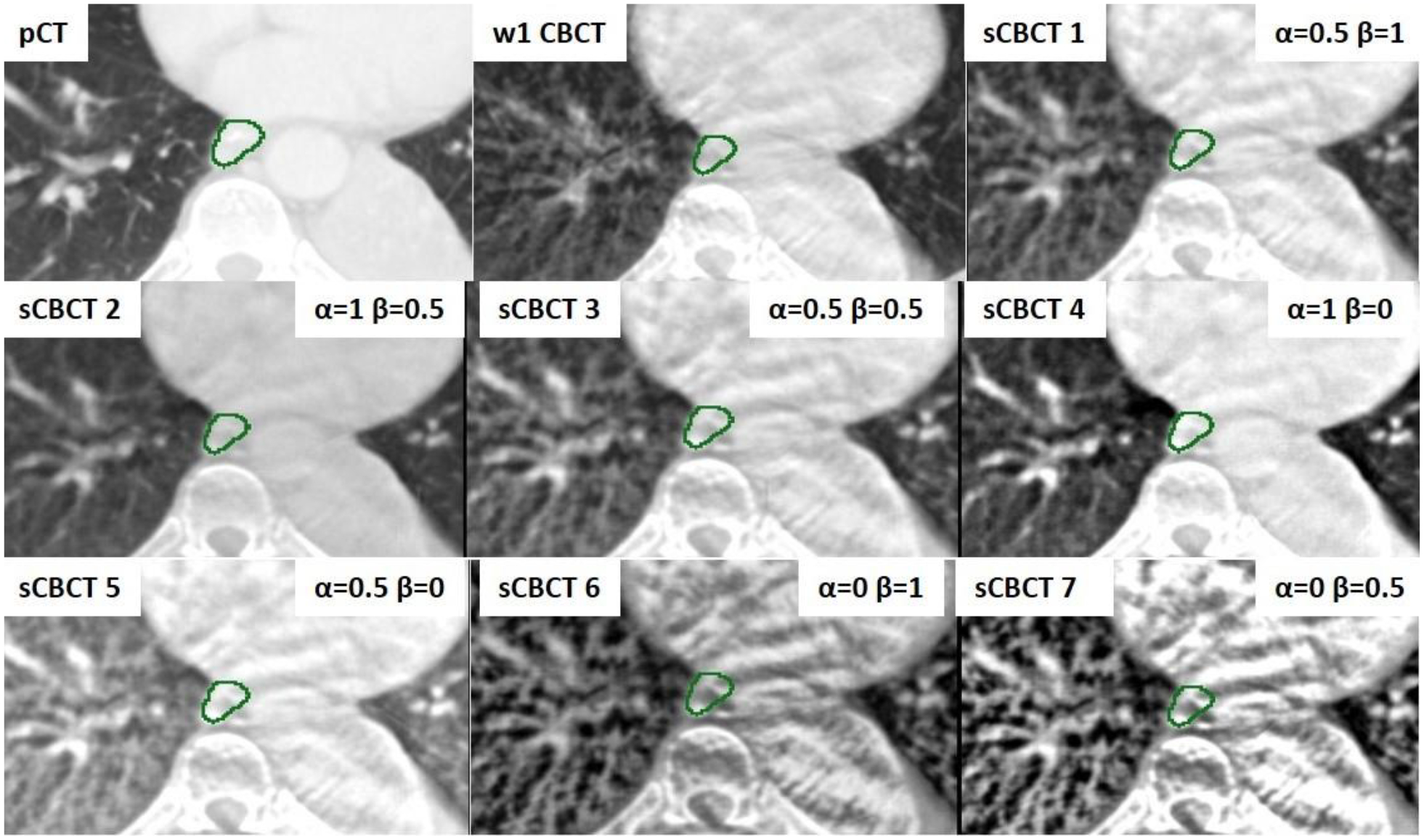 Generalizable Cone Beam CT Esophagus Segmentation using Physics-Based Data Augmentation - PMC