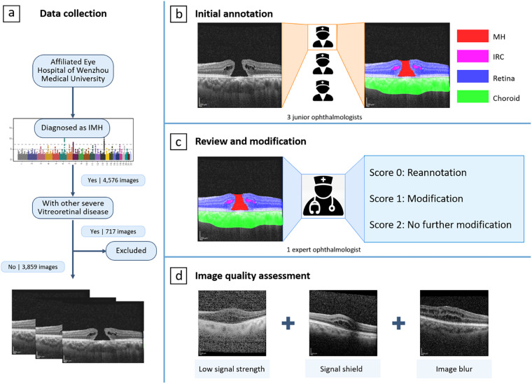 OIMHS: An Optical Coherence Tomography Image Dataset Based on Macular Hole Manual Segmentation - PMC