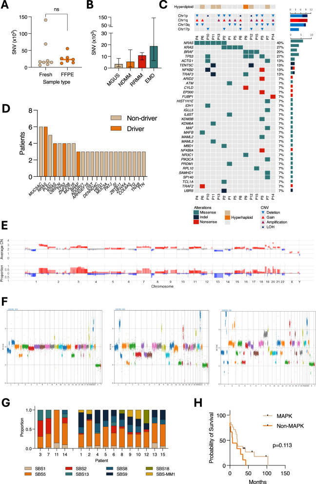 Whole genome sequencing and the genetics of extramedullary disease in multiple myeloma - PMC