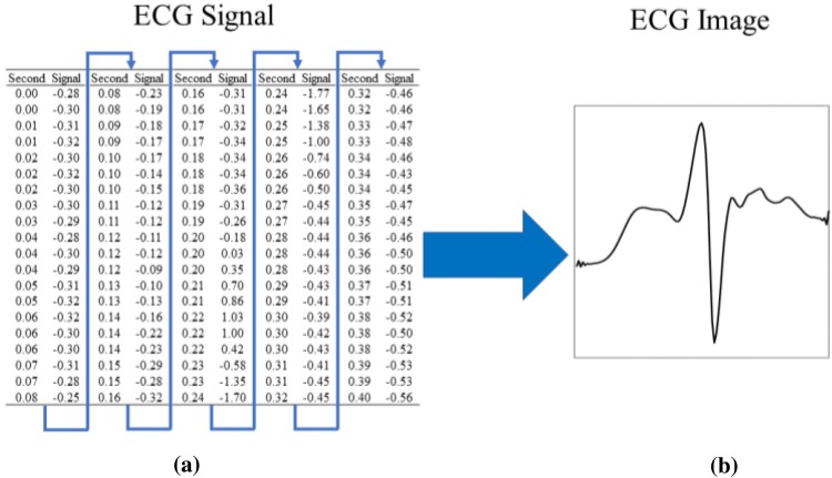 Classification of atrial fibrillation and normal sinus rhythm based on convolutional neural ...