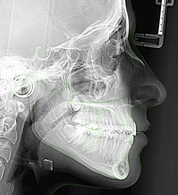 Reliability And Accuracy Of Artificial Intelligence Based Software For