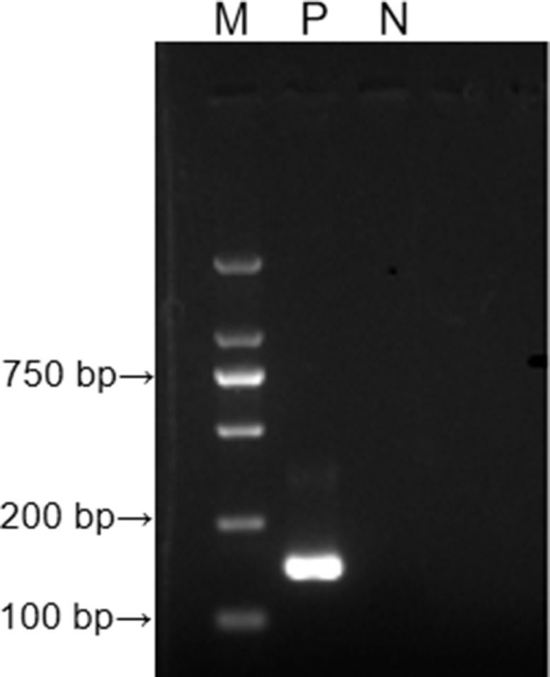 Development and application of a reverse-transcription recombinase-aided amplification assay for ...