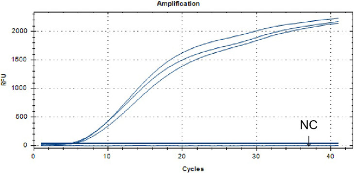 Development and application of a reverse-transcription recombinase-aided amplification assay for ...