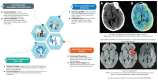Redefining Radiology: A Review of Artificial Intelligence Integration ...