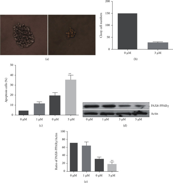 The Significance of PAX8-PPARγ Expression in Thyroid Cancer and the Application of a PAX8-PPARγ ...